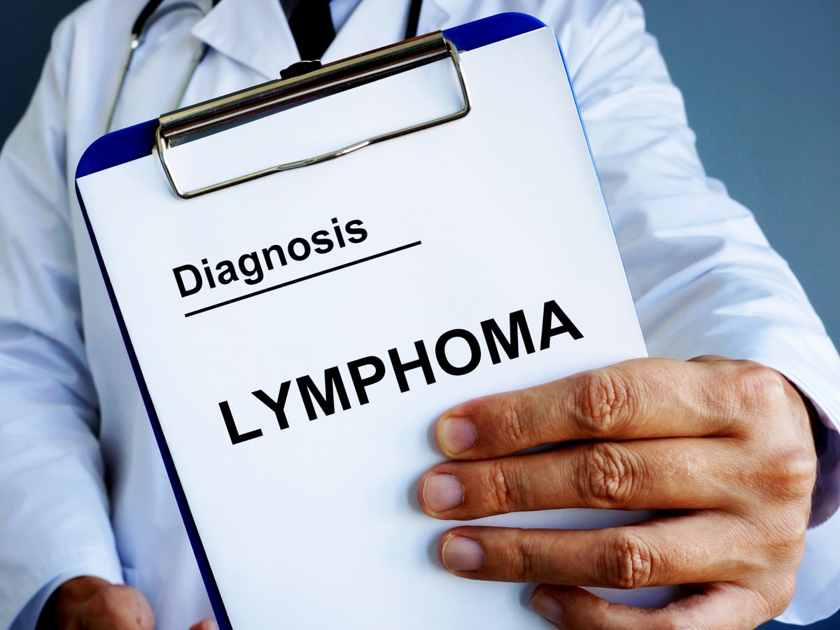 What Are the Symptoms of End Stage Lymphoma? | Sage Family of Companies